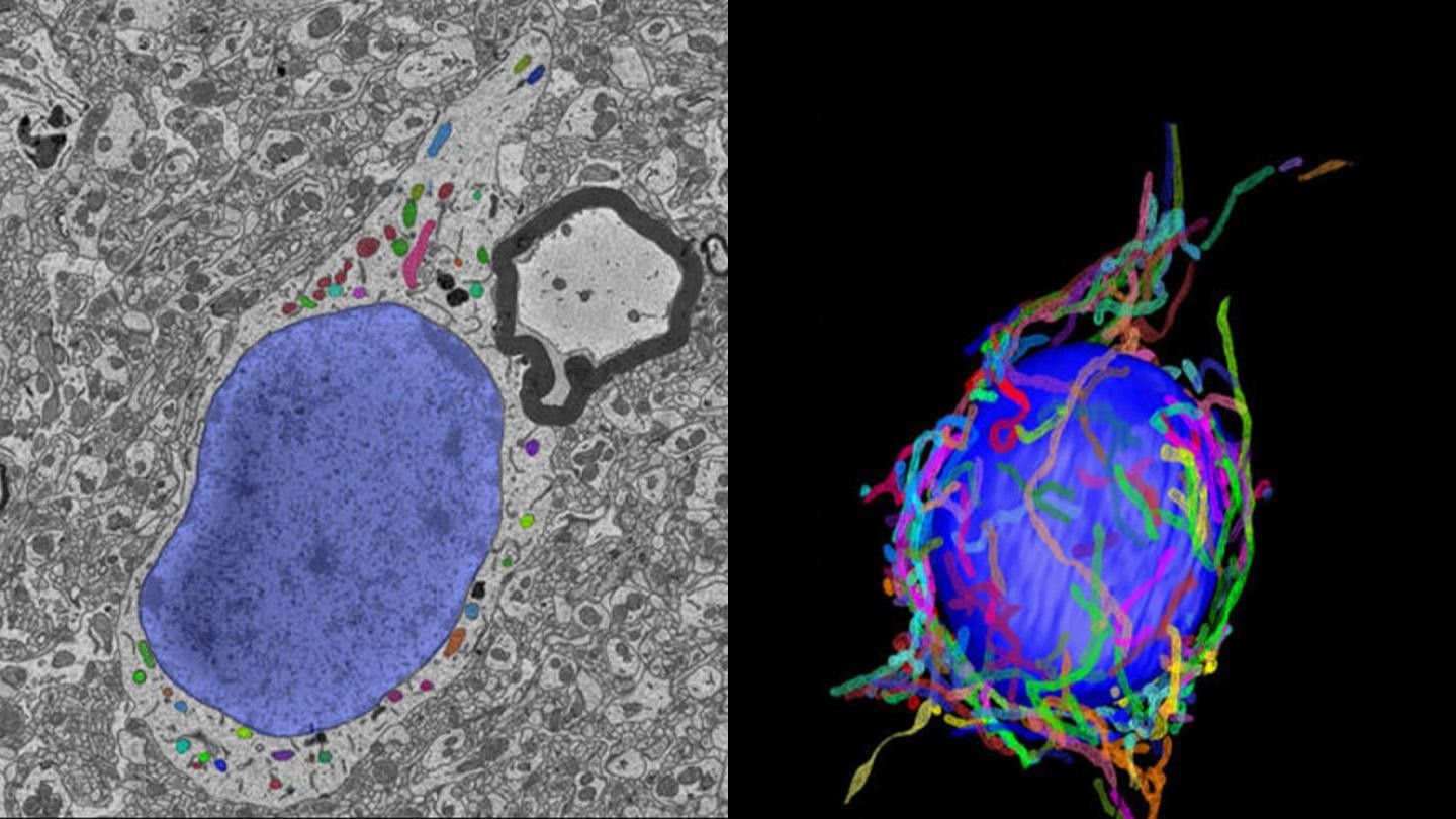 Has the ideal target for treating anxiety been discovered? - EPFL