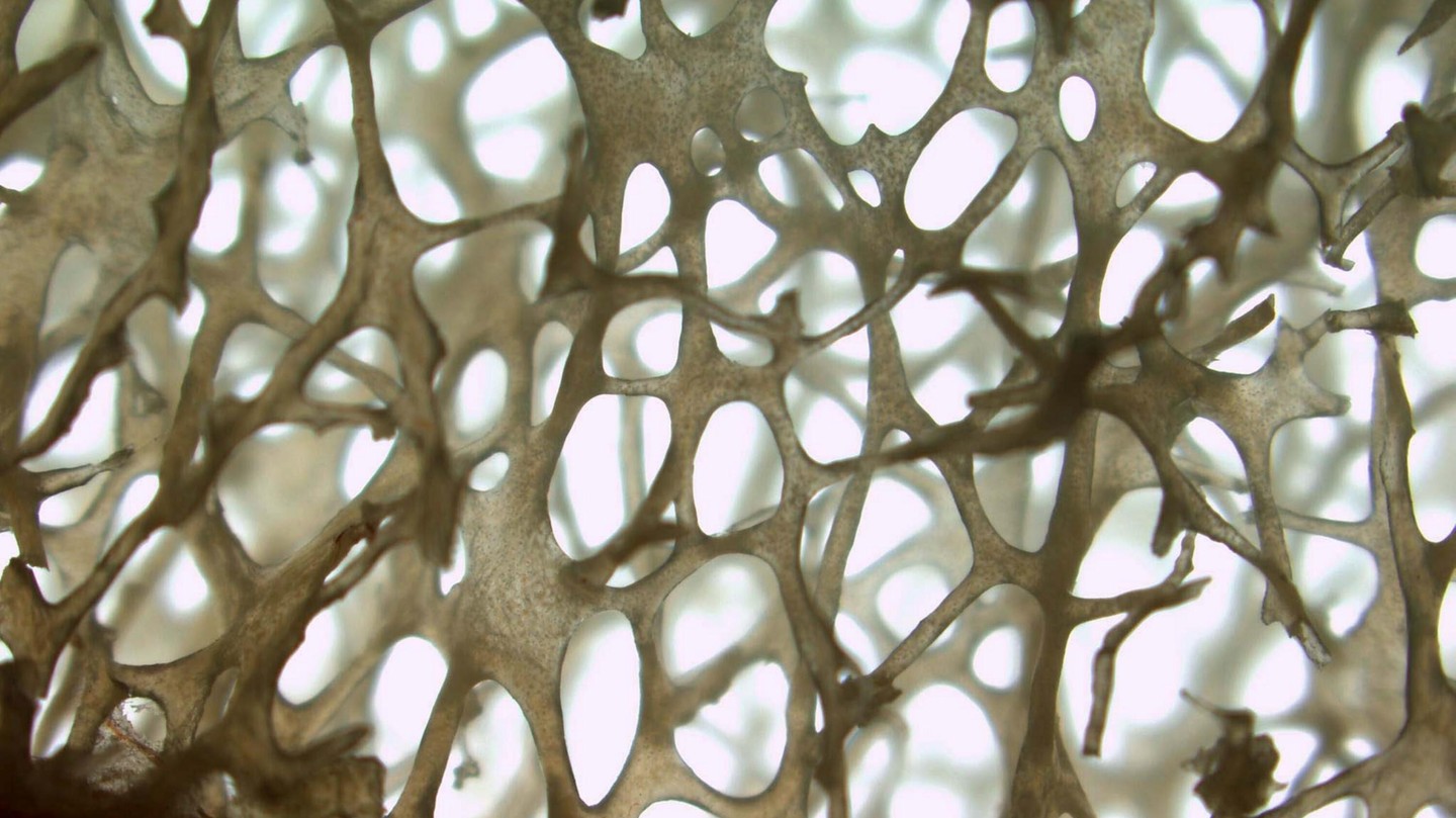 Genetic observation reveals a bone-weakening mechanism - EPFL