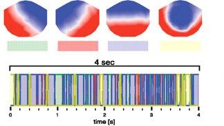 EEG in healthy humans. - EPFL