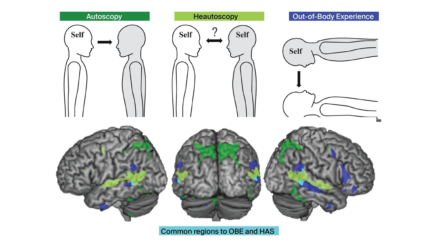 New publication on the brain networks of autoscopic phenomena - EPFL