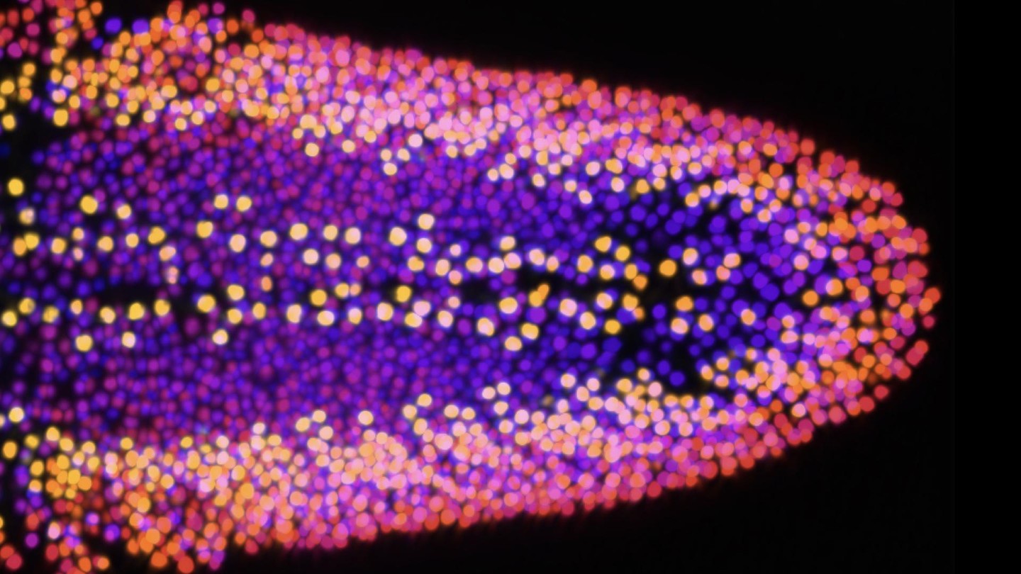 Protein ‘traffic jam' in neurons linked to neurodegeneration - EPFL