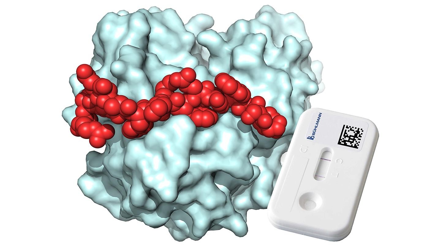 Un nouveau peptide synthétique détecte un marqueur inflammatoire clé - EPFL