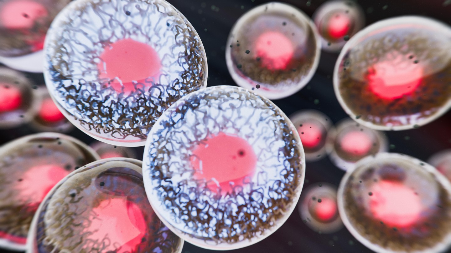 Bioengineering ‐ EPFL