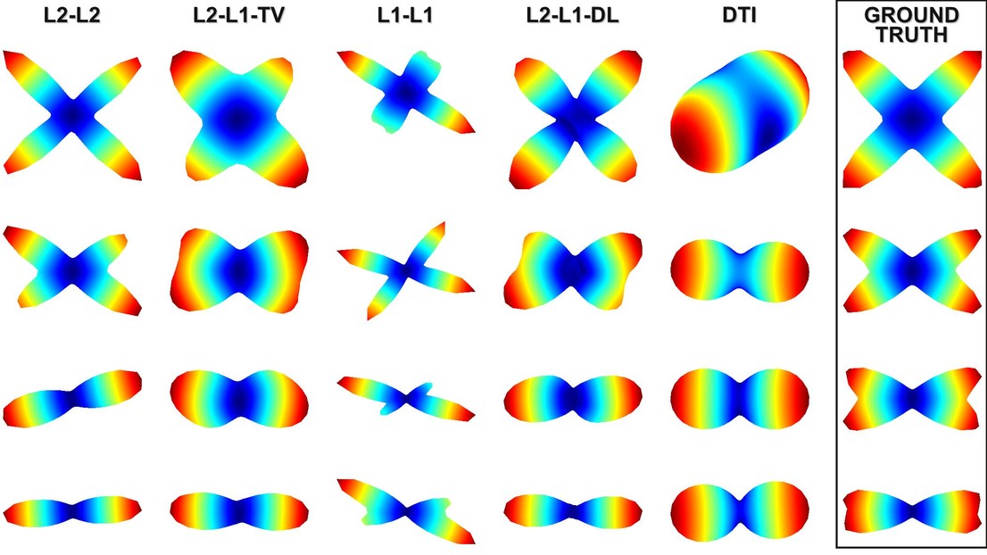 New paper in diffusion MRI by Alessandro Daducci et al. - EPFL