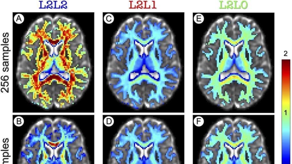 New paper in diffusion MRI by Alessandro Daducci et al. - EPFL