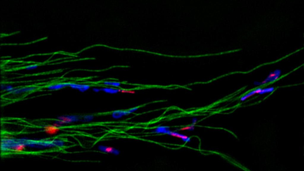 A new molecule for high-resolution cell imaging - EPFL