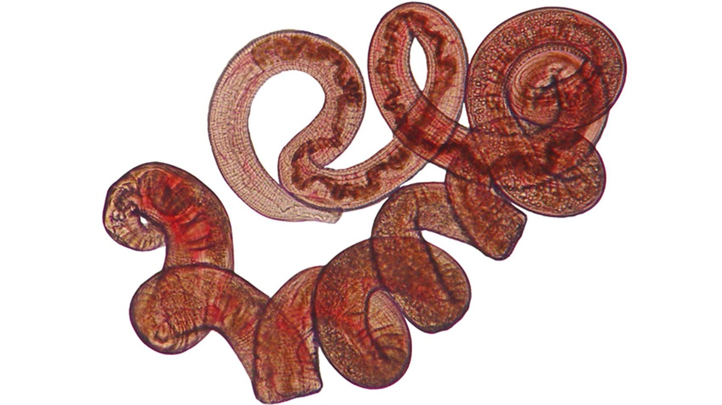 How the immune system fights worm infections - EPFL