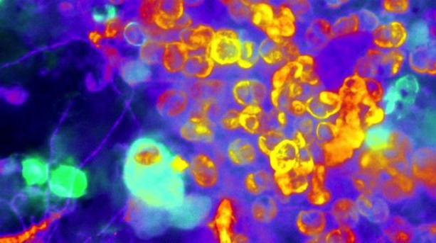 Biofilms: The slippery foundation of stream ecosystems - EPFL