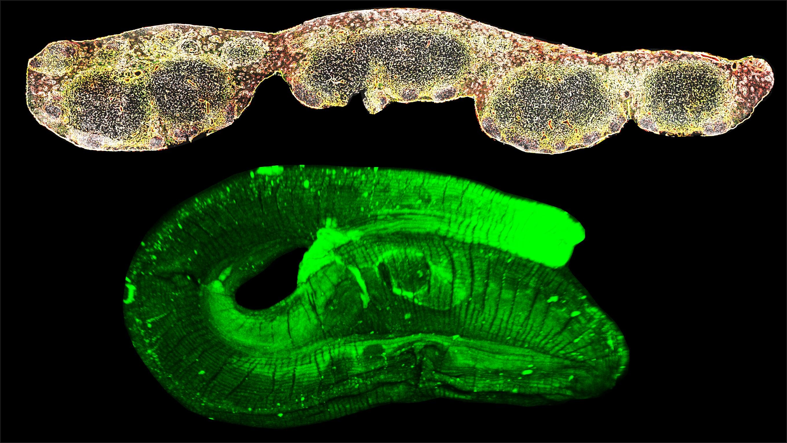 Les vers intestinaux stimulent le système immunitaire