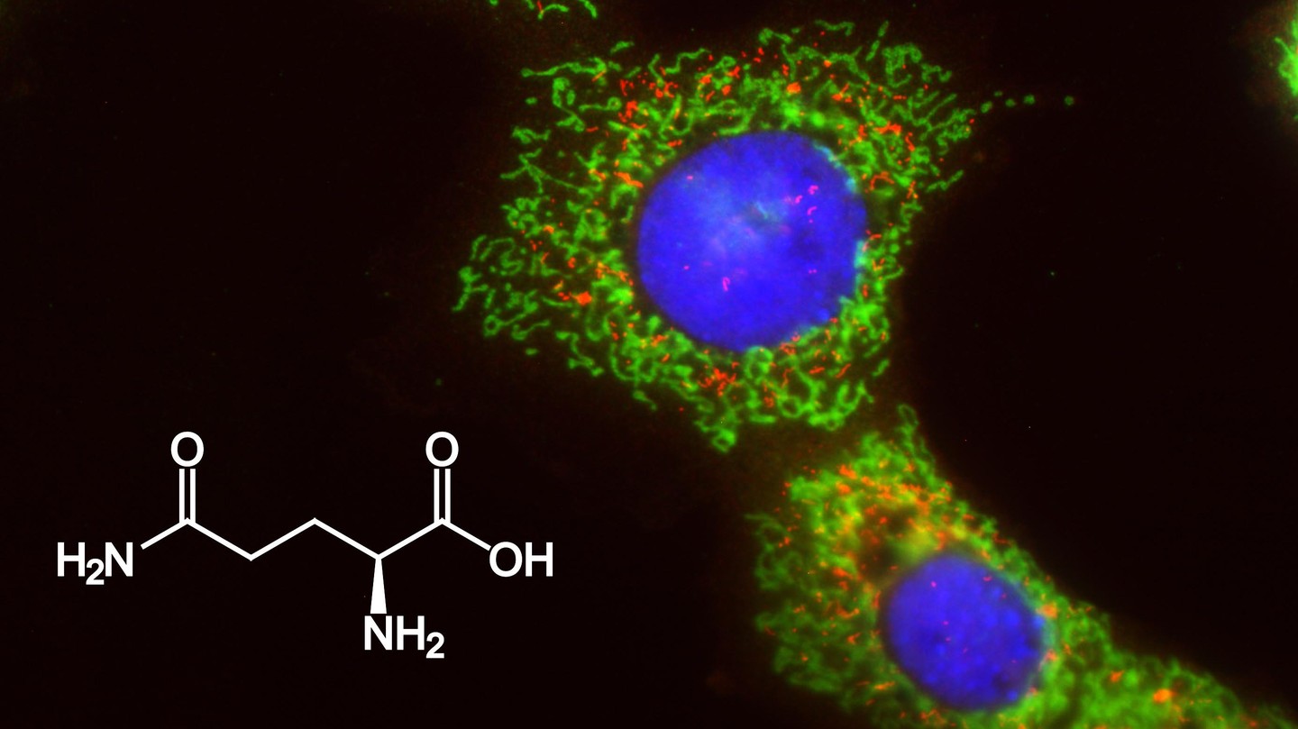 Starving cancer cells by blocking their metabolism - EPFL