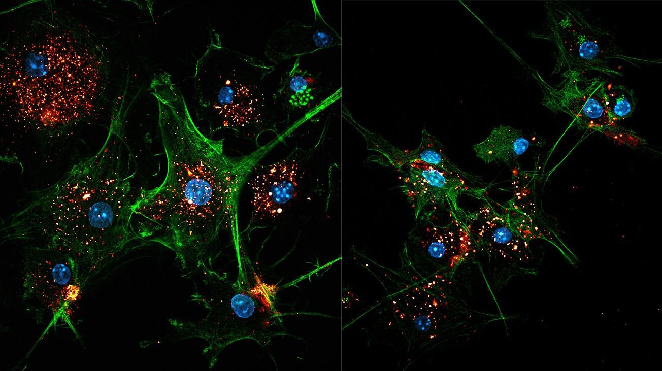 Des « cibles » de synthèses pour renforcer les immunothérapies - EPFL