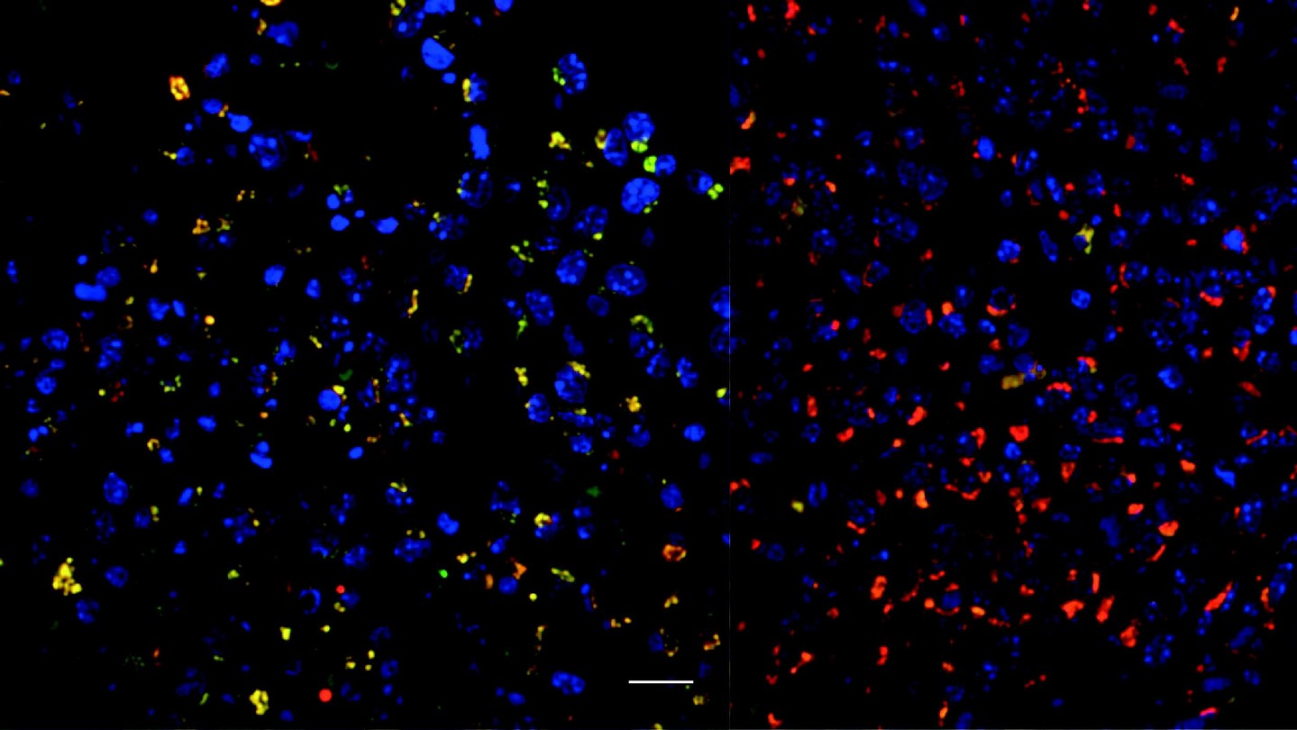 Cluedo in the cell: enzyme location controls enzyme activity - EPFL