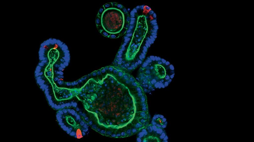 Un organoïde, pour quoi faire ? - EPFL