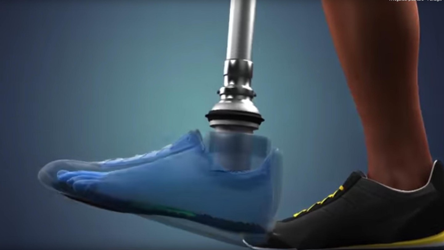 Feeling Legs Again Improves Amputees' Health - EPFL