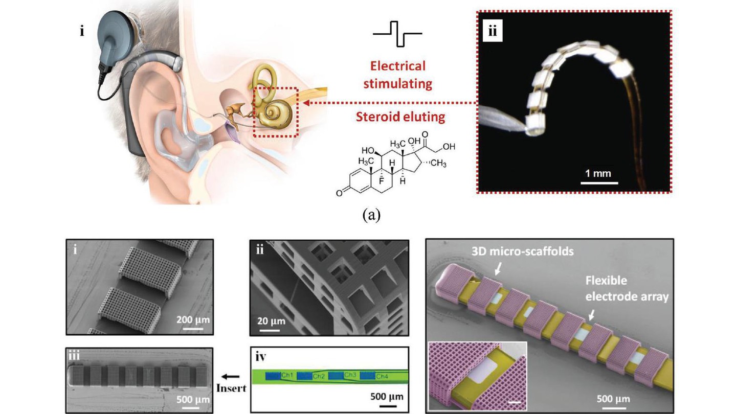 A 3D Microscaffold Cochlear Electrode Array for Steroid Elution - EPFL A 3D Microscaffold Cochlear Electrode Array for Steroid Elution - EPFL