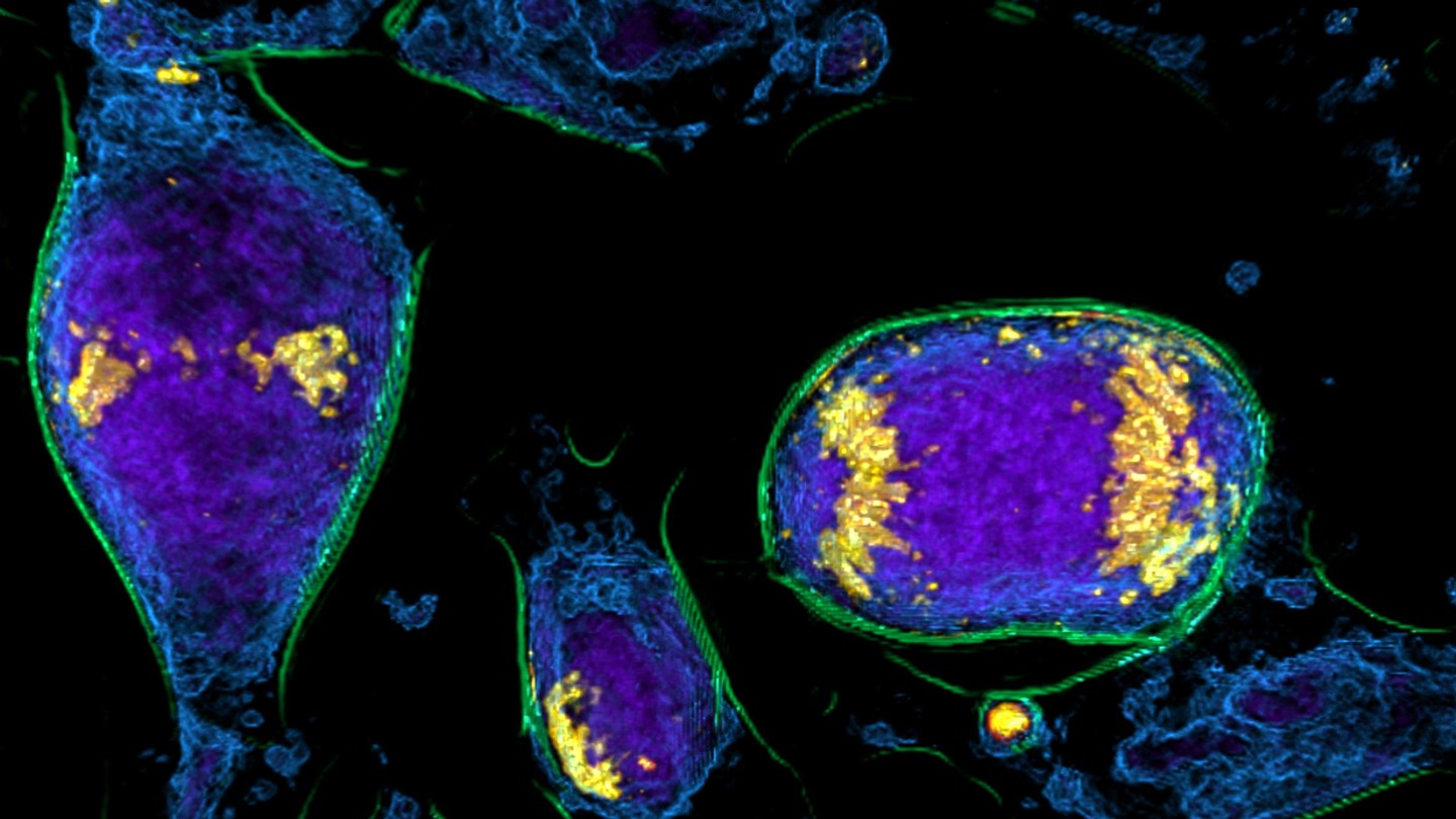New technology to observe and quantify intracellular phenomena - EPFL