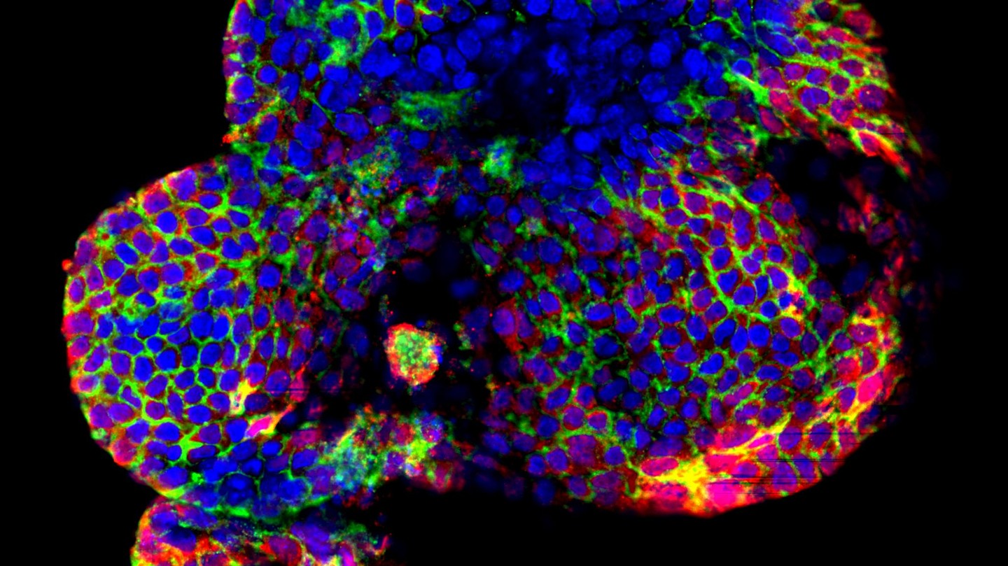 Transplantable lab-grown organs move a step closer - EPFL