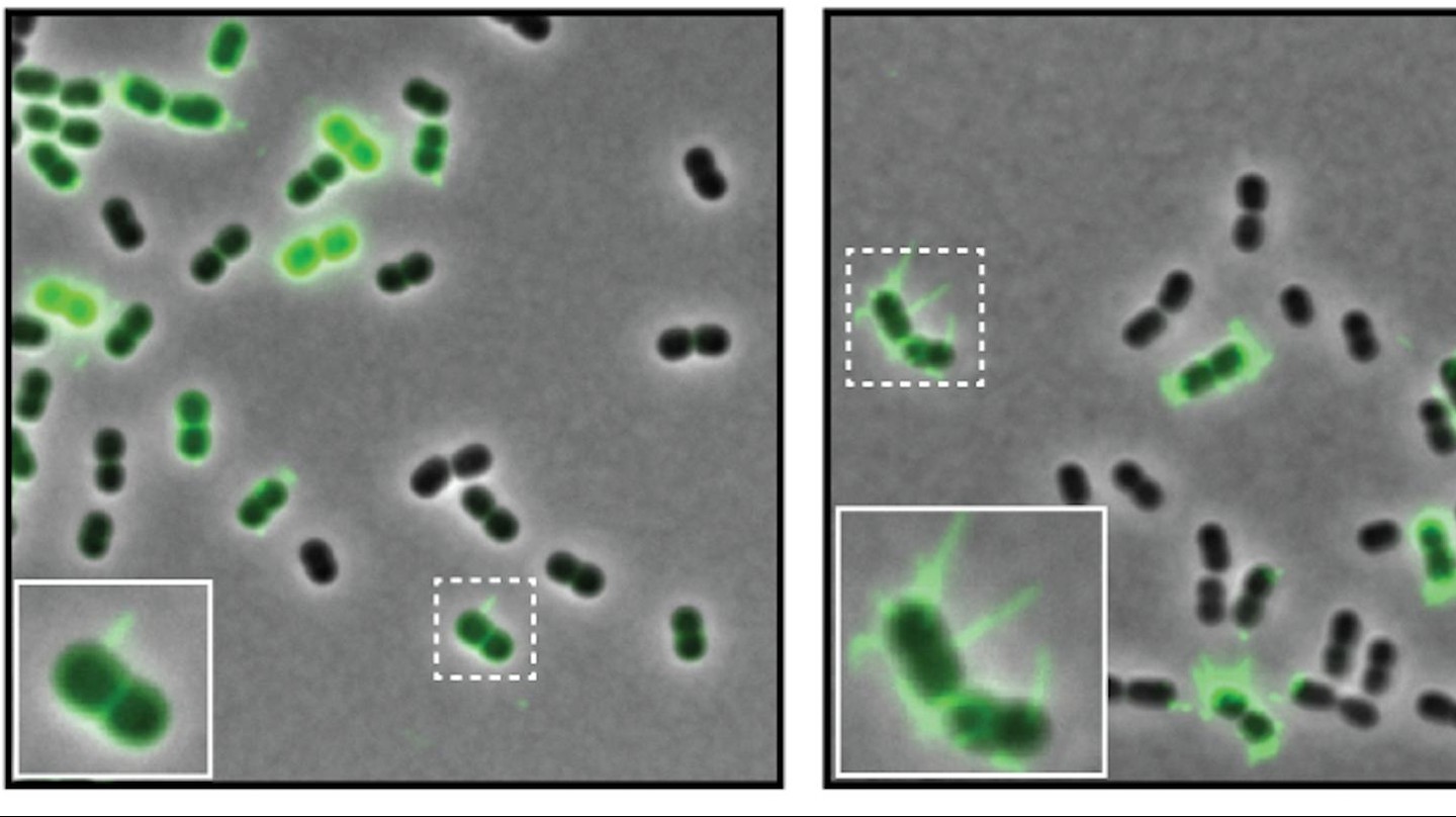 First publication of the lab on the pathogen Acinetobacter baumannii - EPFL