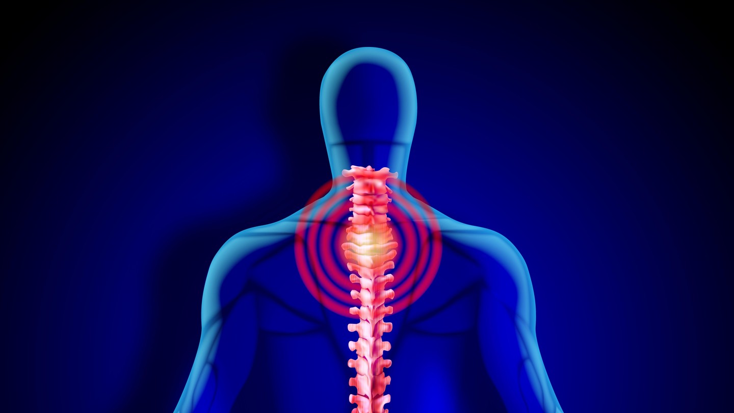 New treatment helps patients with a spinal cord injury - EPFL